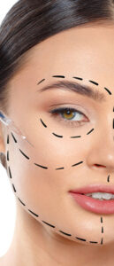 Cheek Filler Cardiff | drnancy | Home